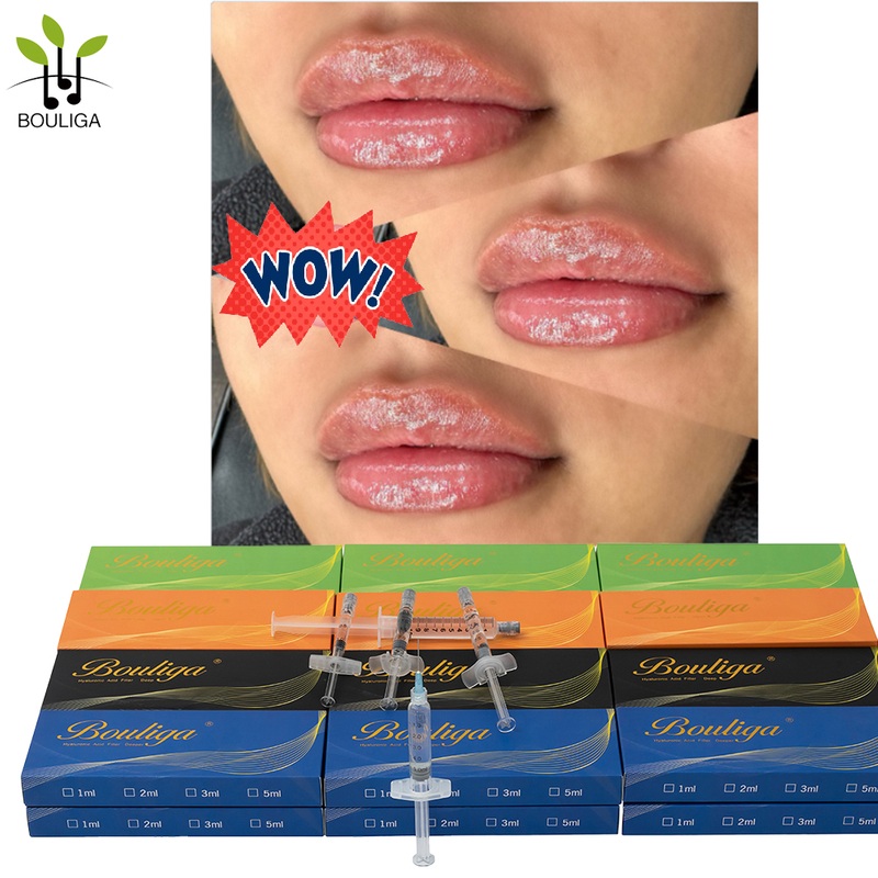 Bouliga 100% hyaluronic acid No needles, Non invasive dermal filler for ...
